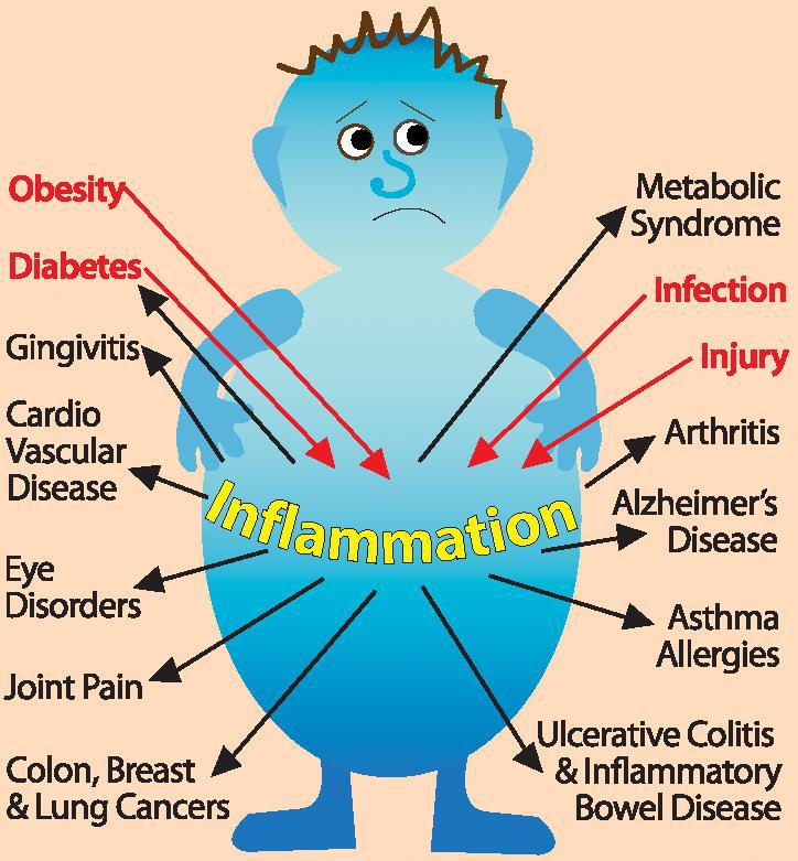Dangers of Inflammation - Your Health Is At Risk! - Hometown Family ...