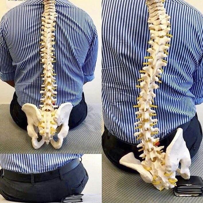 Sitting On Your Wallet or Cell Phone Can Cause Back Pain - Hometown ...